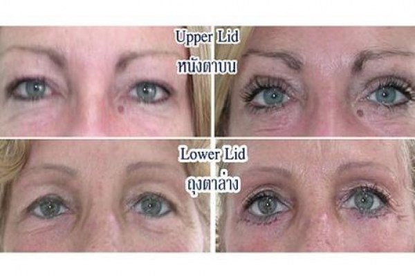 Dr. Fu Cosmetic Facial Surgery Clinic - Phuket.Net